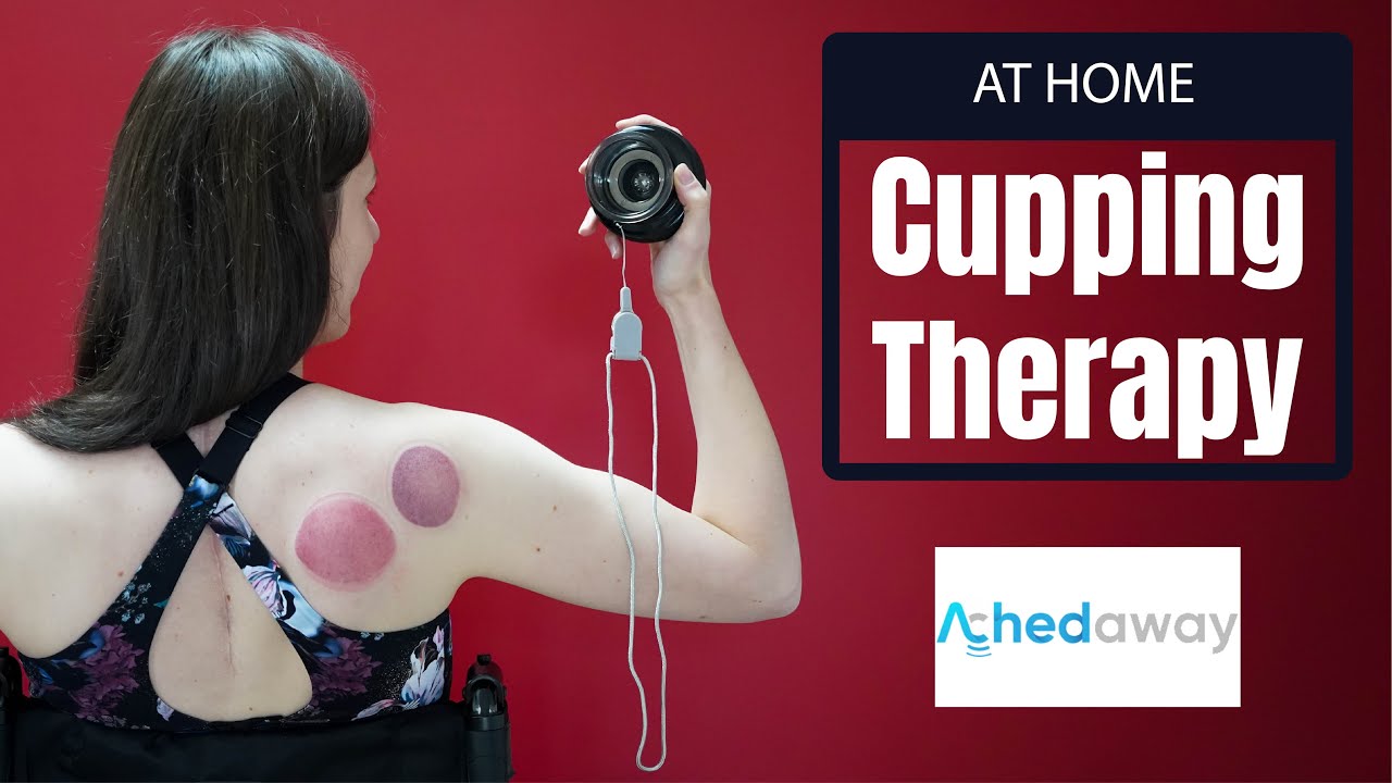 Self Cupping Therapy - YouTube
