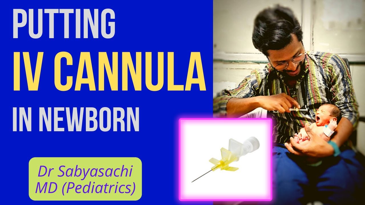 Putting IV cannula in Newborn baby/ Newborn cannulation/ Pediatric ...