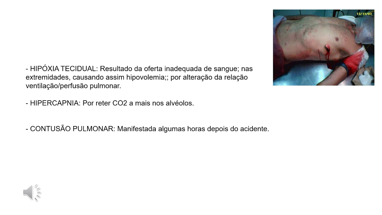 Trabalho de emergência Trauma de Tórax aberto e fechado - YouTube