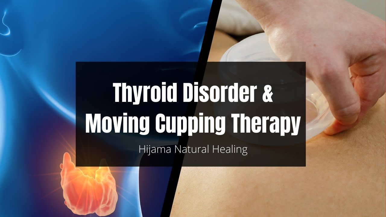 How Moving Cupping Therapy helps with Thyroid Disorder? - YouTube