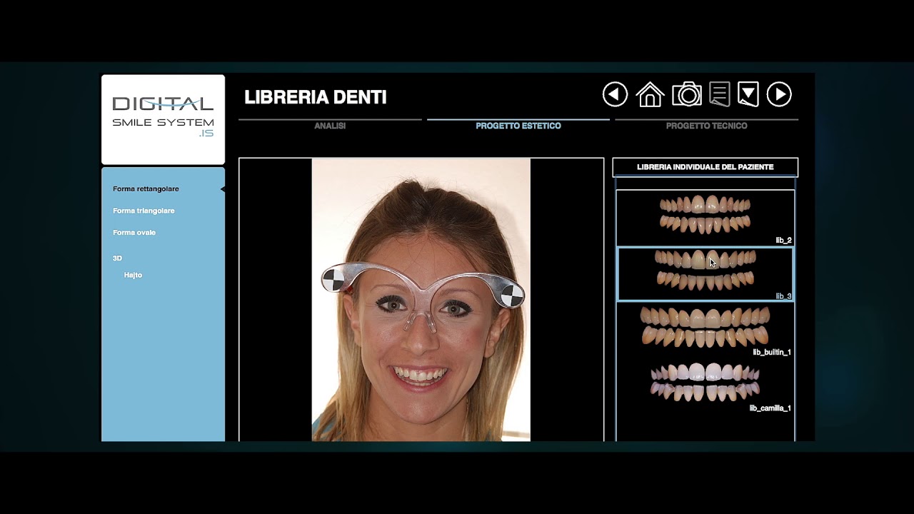 DIGITAL SMILE SYSTEM - YouTube
