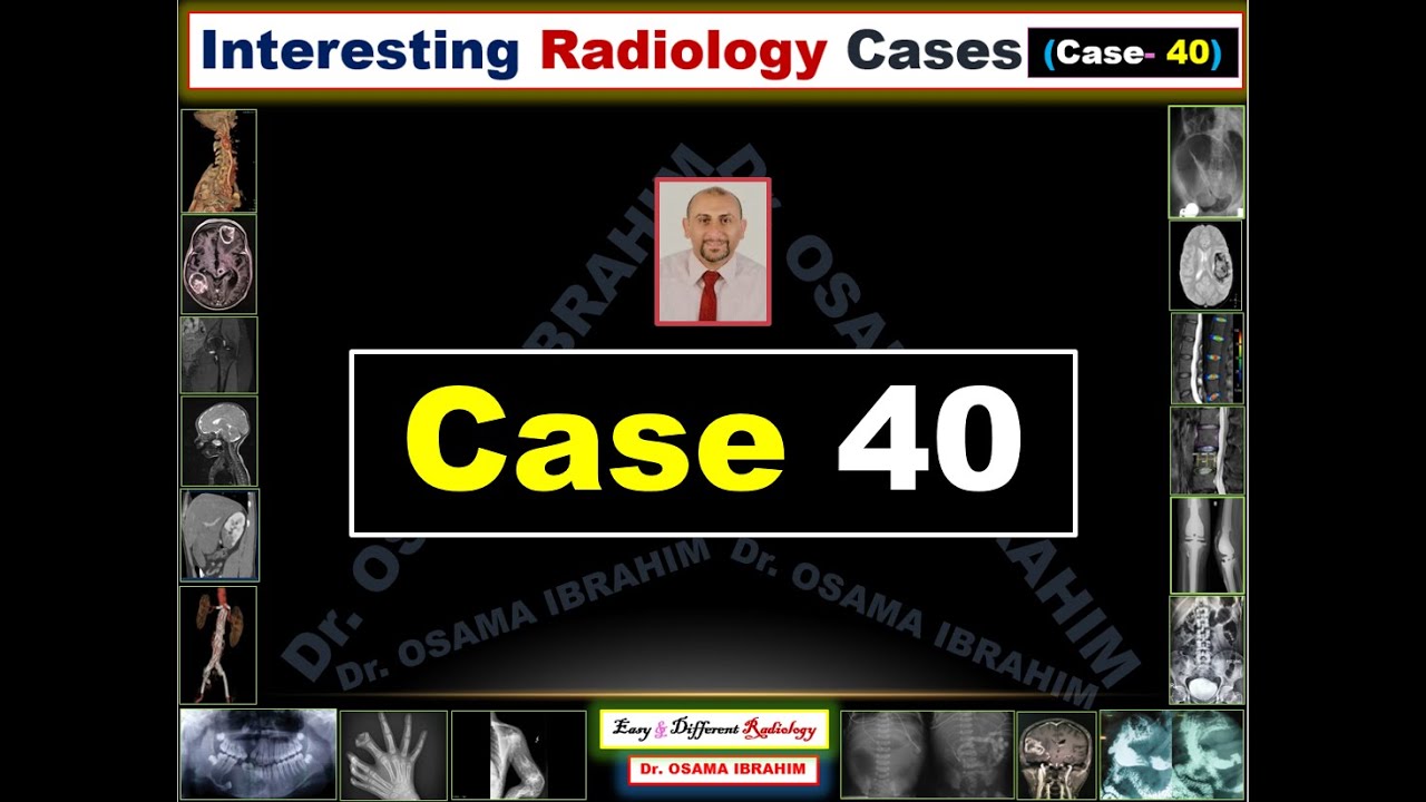 Interesting Radiology Cases (Case- 40) - YouTube