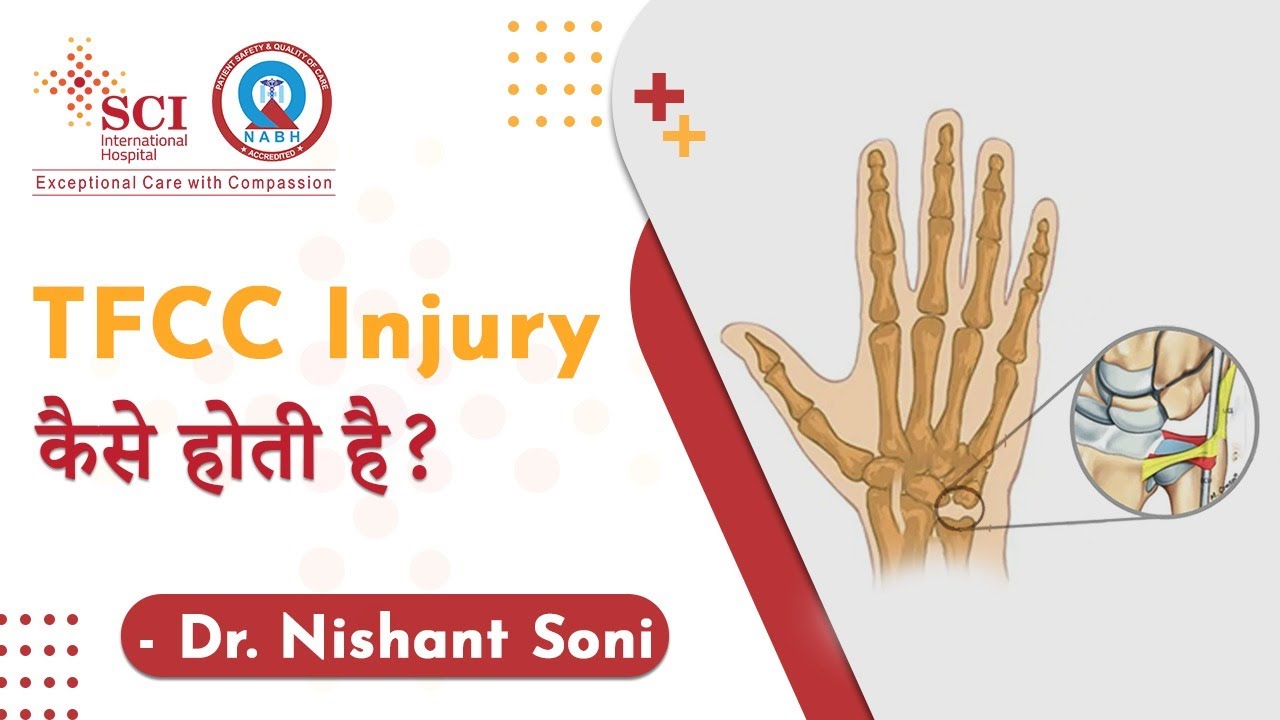 What is TFCC Injury ? ( TFCC क्या होता है ? ) | SCI Hospital - YouTube