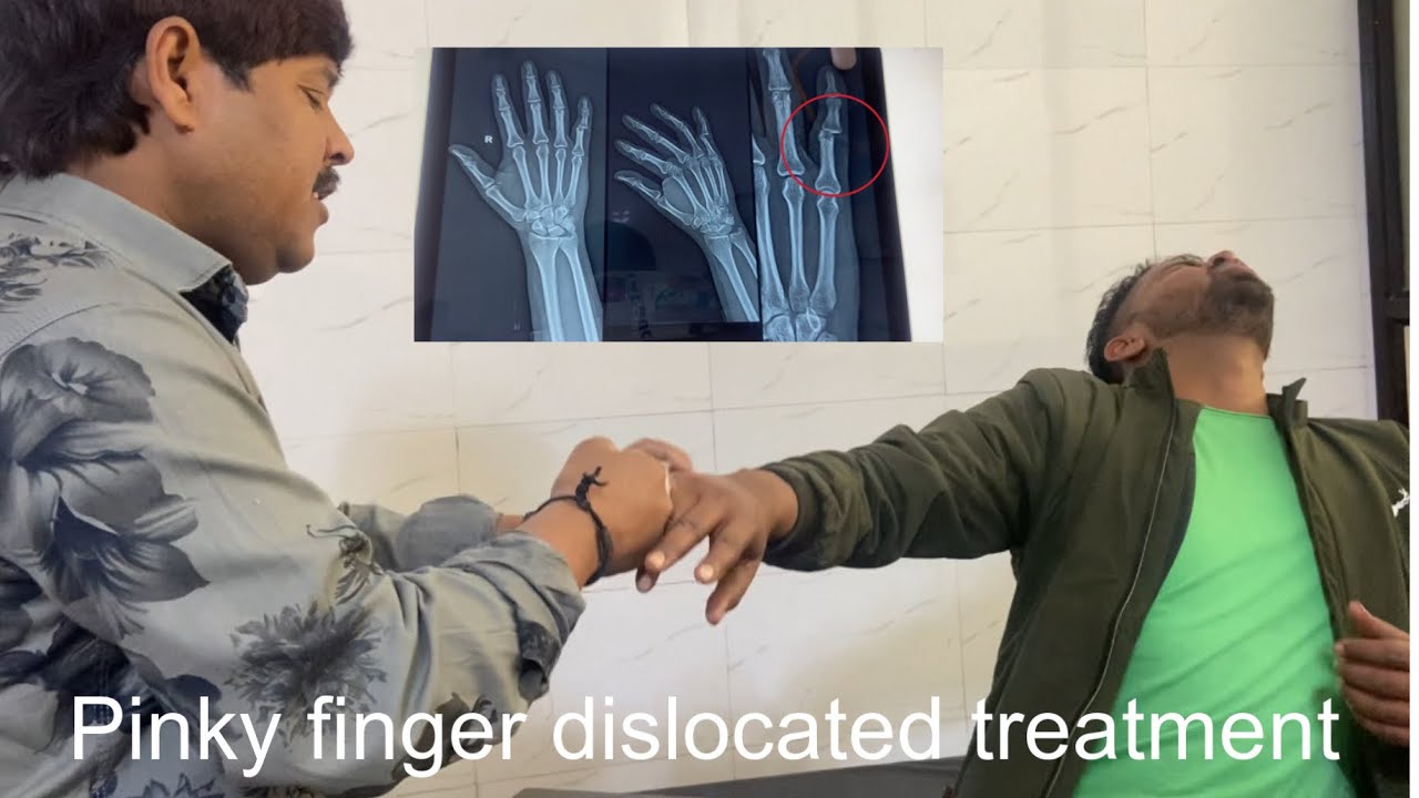 Pinky finger dislocated treatment ajmer ||jai bhagwan therapy centre ...