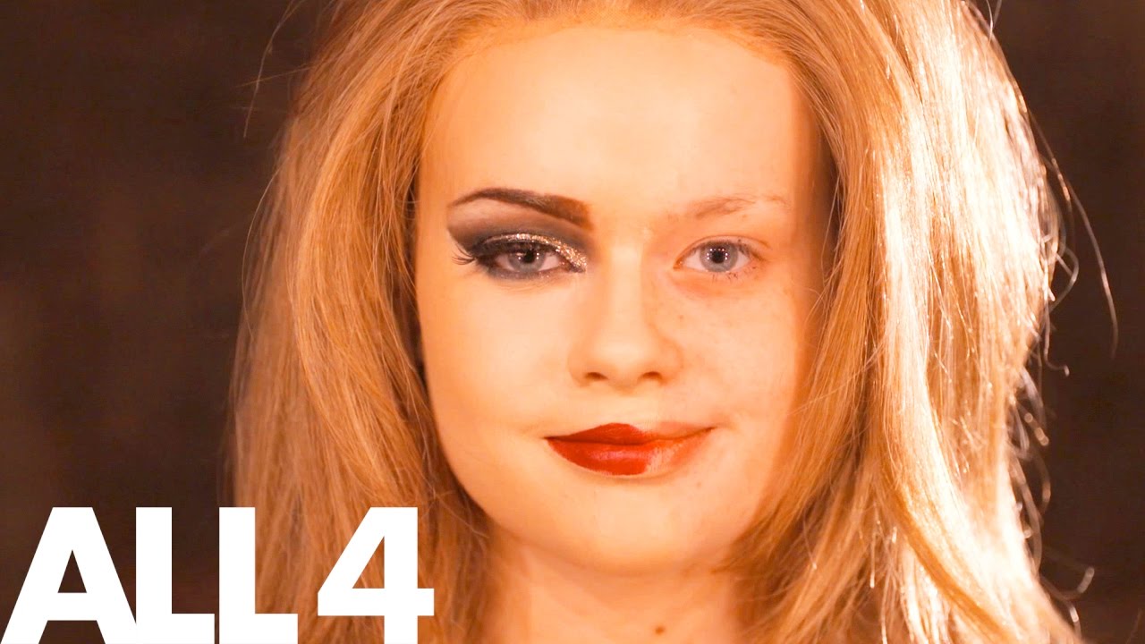 Bald And Proud, Girl With Alopecia Loses All Hair In One Week - YouTube