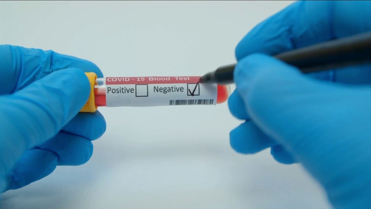 False negatives a concern with COVID tests - YouTube