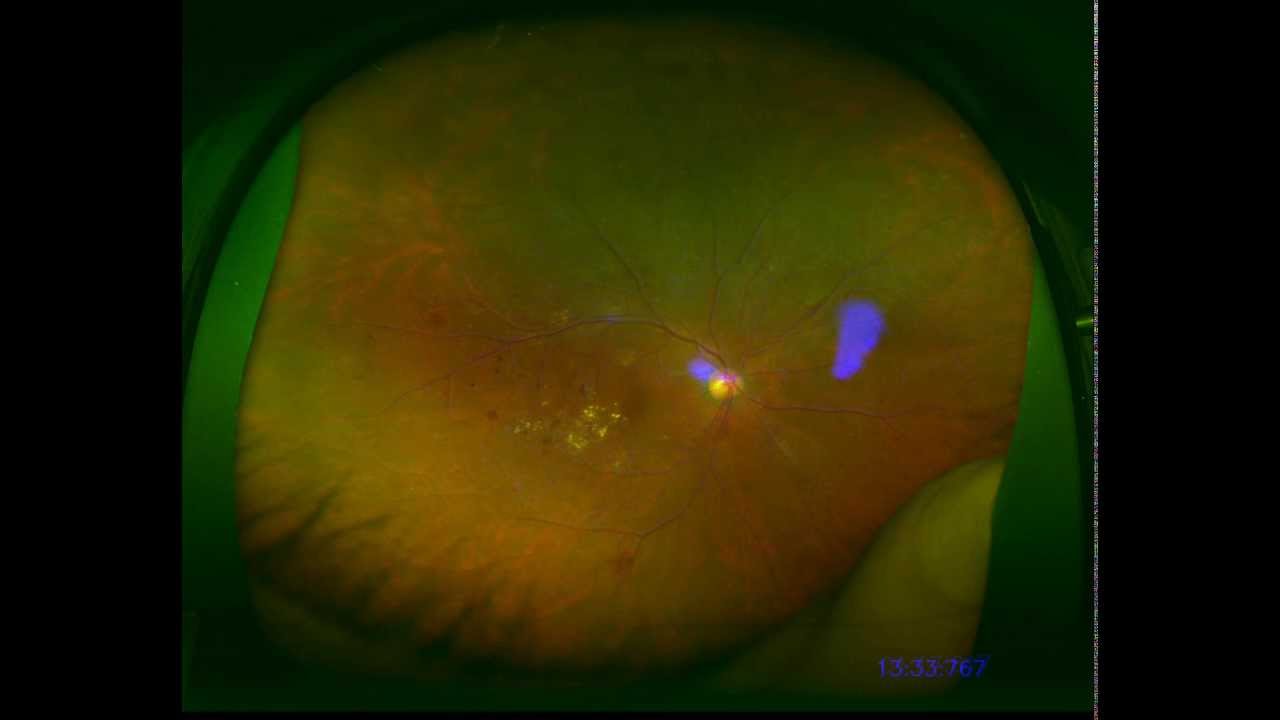 DMR-FA BY OPTOS - YouTube