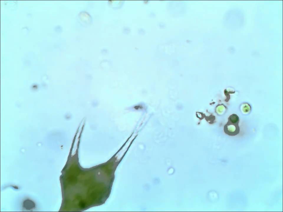 Dinoflagellate - YouTube