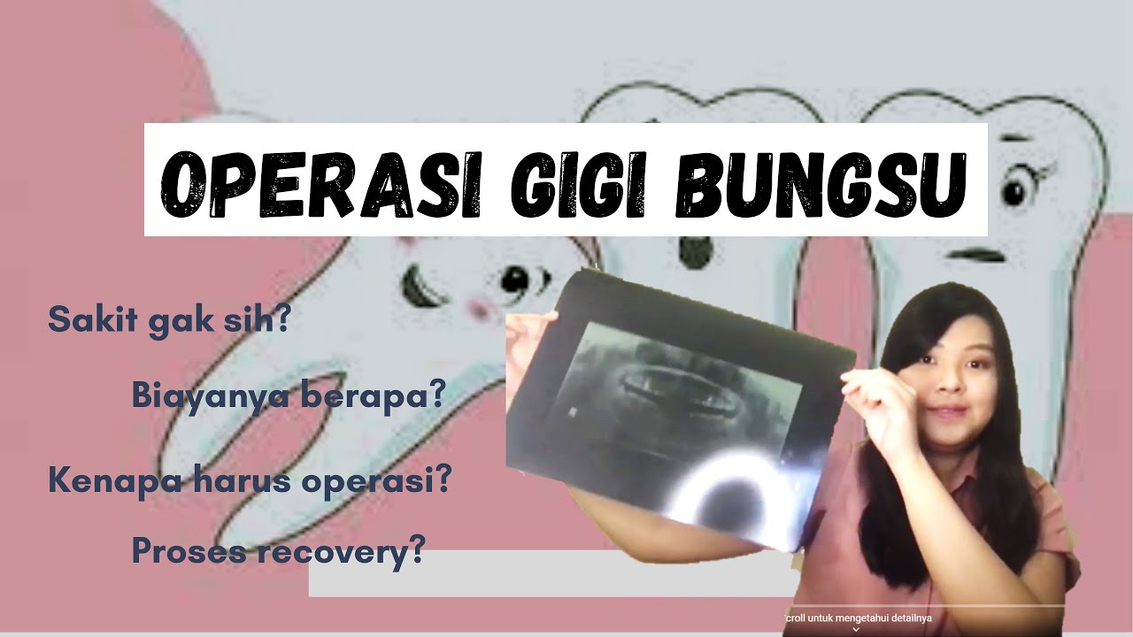 Sharing Pengalaman OPERASI GIGI BUNGSU (Wisdom Teeth) + Biaya + Jenis ...