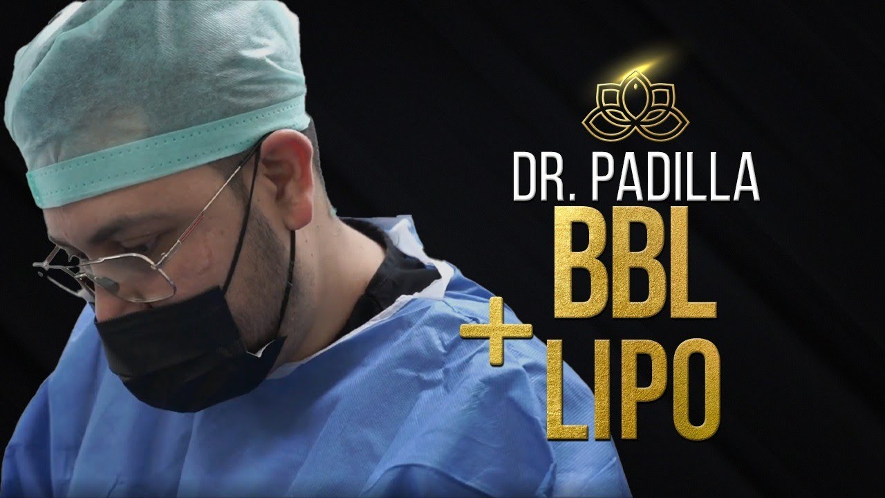 Succesful BBL in Mexico! by Dr Padilla at Vive Plastic Surgery ...
