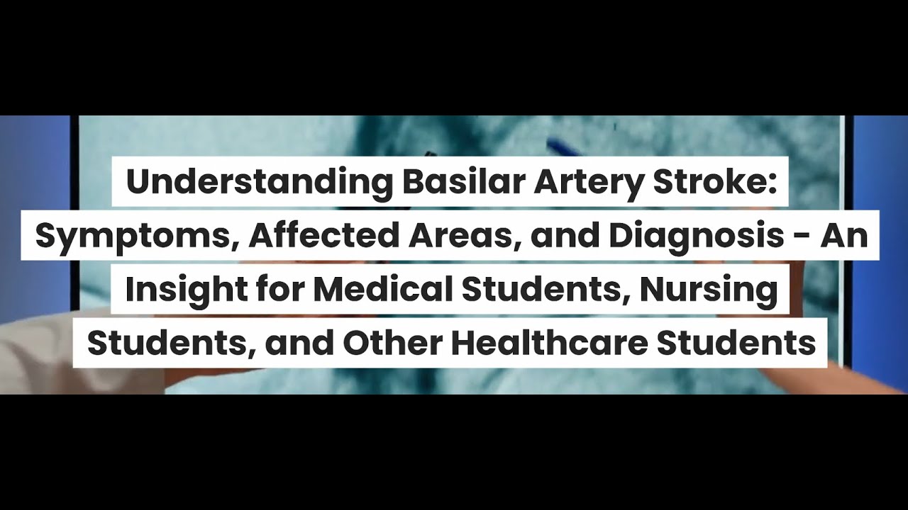 Understanding Basilar Artery Stroke: Symptoms, Affected Areas, and ...