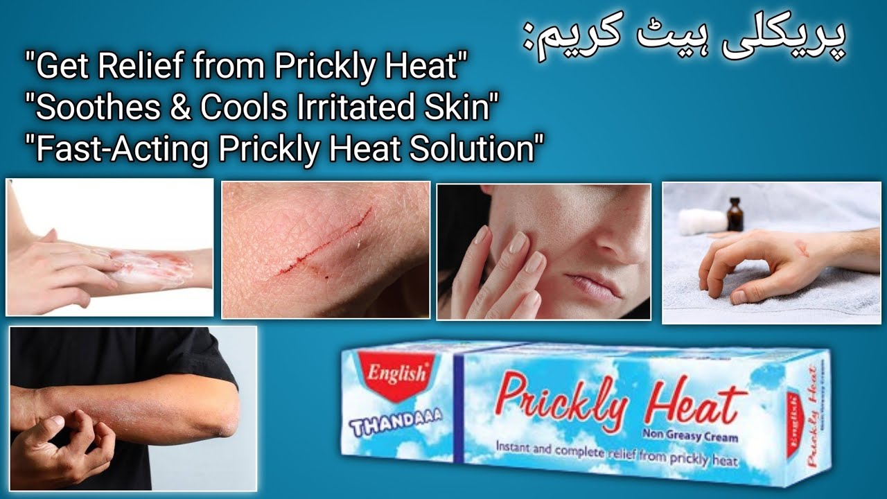 Complete Guide to Prickly Heat Cream - Uses, Benefits, and Precautions ...