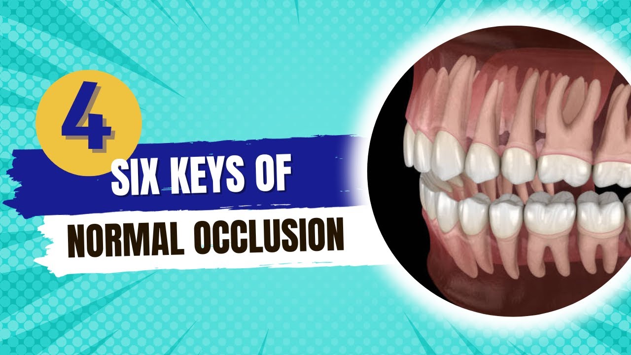 Six Keys Of Normal Occlusion Orthodontics Course Youtube