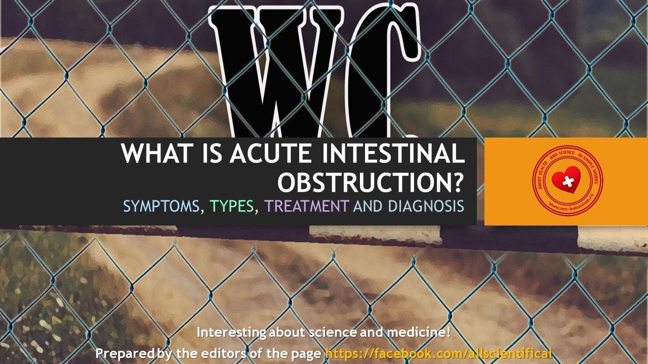 What is acute intestinal obstruction? Types, symptoms and treatment ...