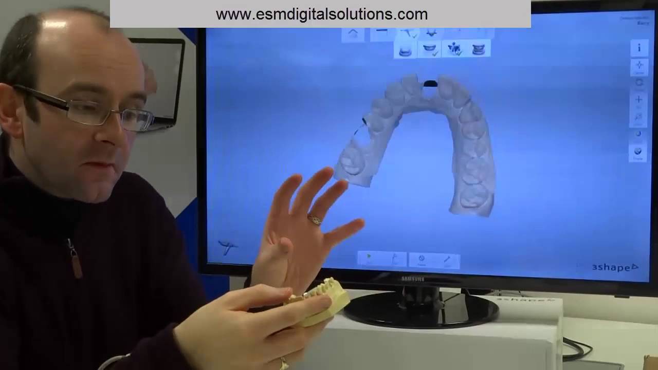 TRIOS Implant Scanning - YouTube