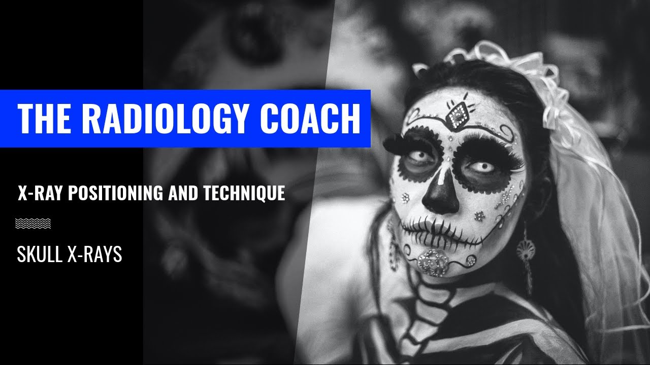 How to PERFORM an X-RAY examination of the SKULL - YouTube