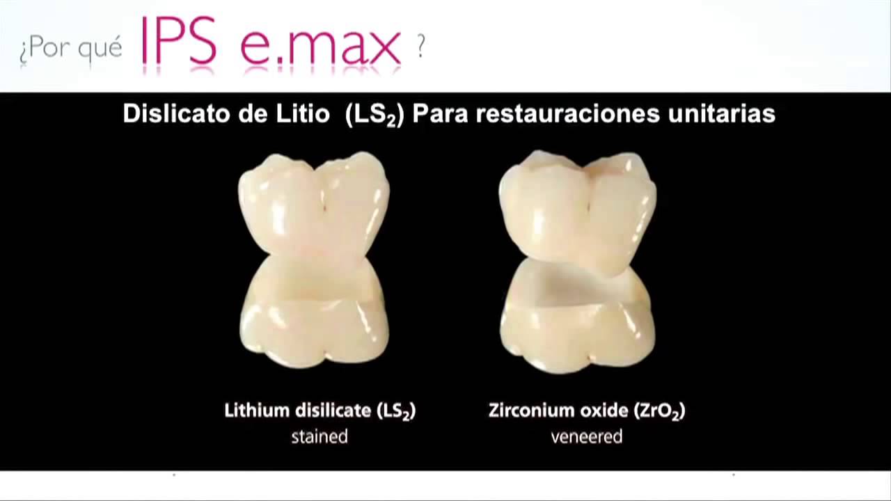 Qué es y cómo usar IPS e max - YouTube