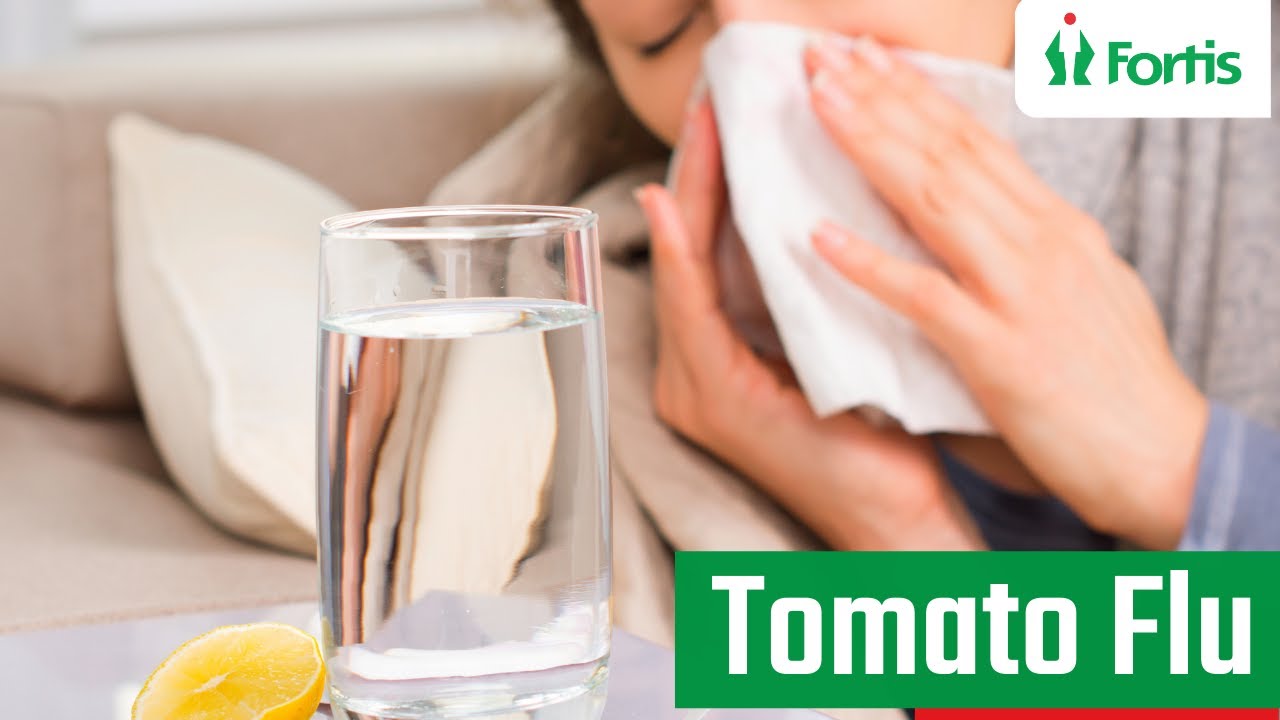Tomato Flu | Symptoms of tomato Flu | Tomato Virus | Tomato Flu vs ...