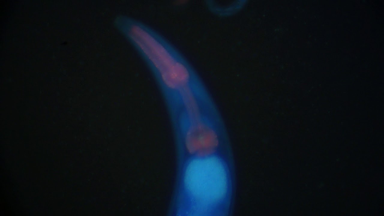 Caenorhabditis elegans nematode under epifluorescent microscope. - YouTube