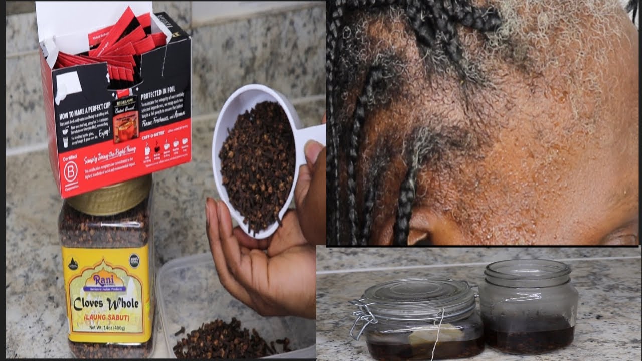 HOW I MAKE CLOVE WATER FOR THICKER FULLER HAIR AND LESS HAIR SHEDDING how-i-make-clove-water-for-thicker-fuller-hair-and-less-hair-shedding