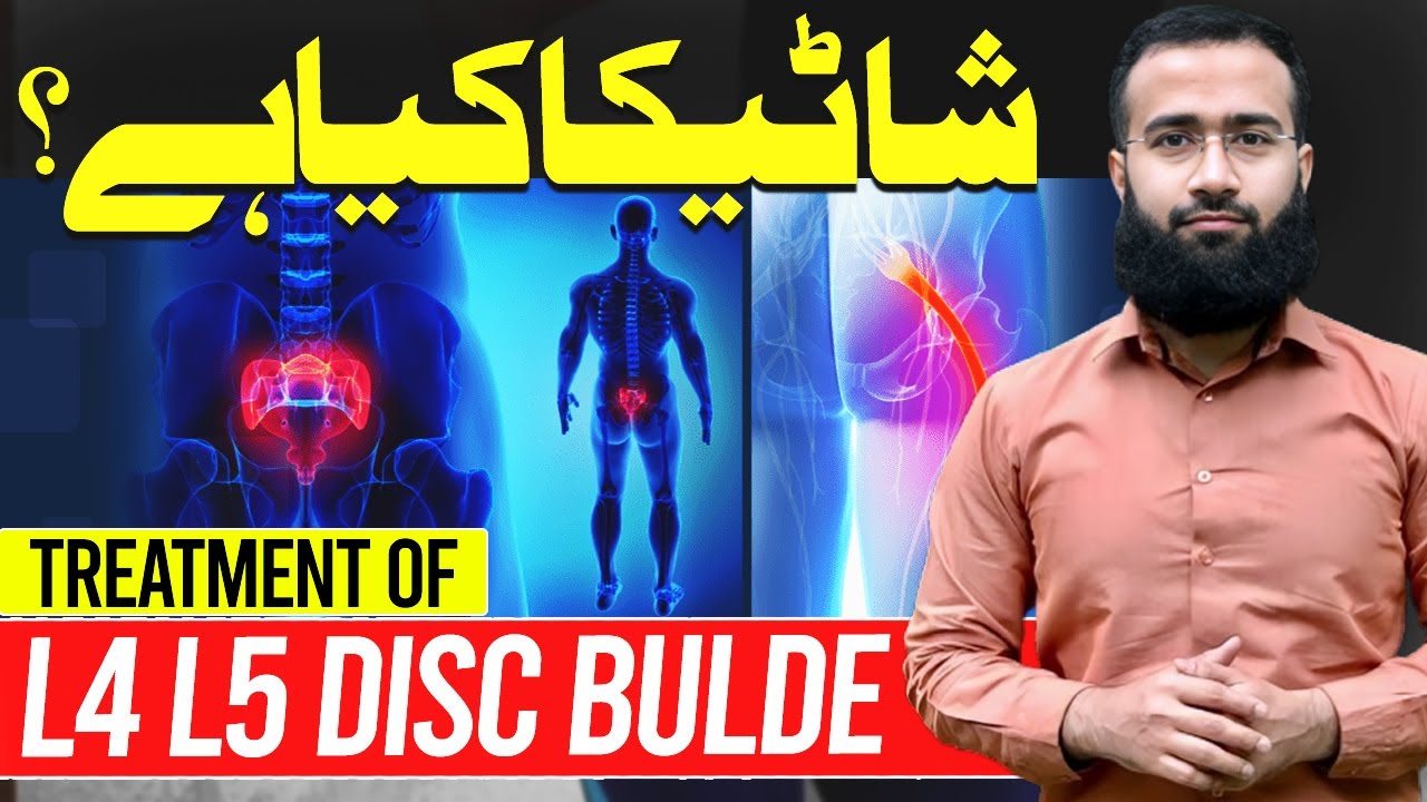 What is Sciatica? Treatment of L4L5 Disc Bulde or Herniation - YouTube