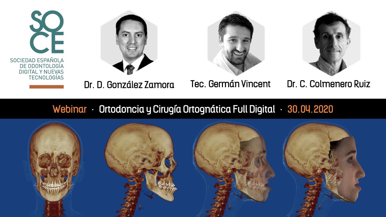 Ortodoncia y Cirugía Ortognática Full Digital - David González - César ...