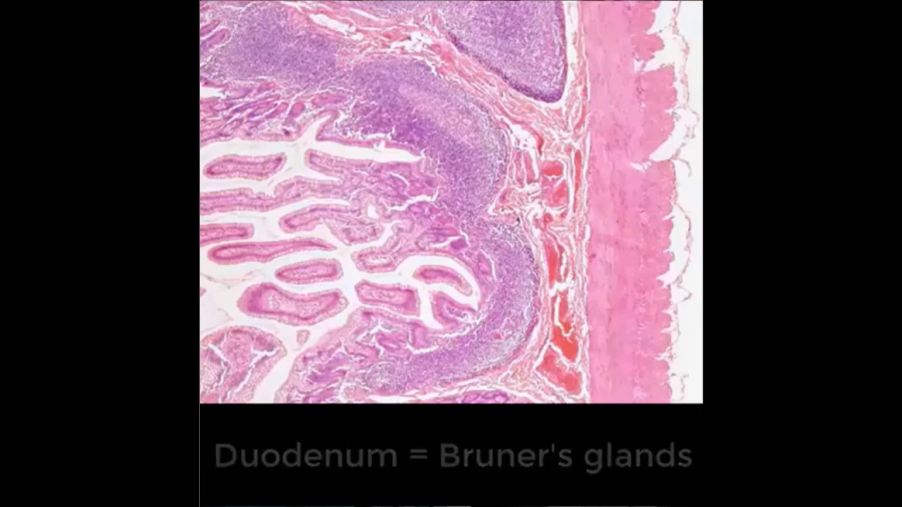 Peyer's patches - YouTube