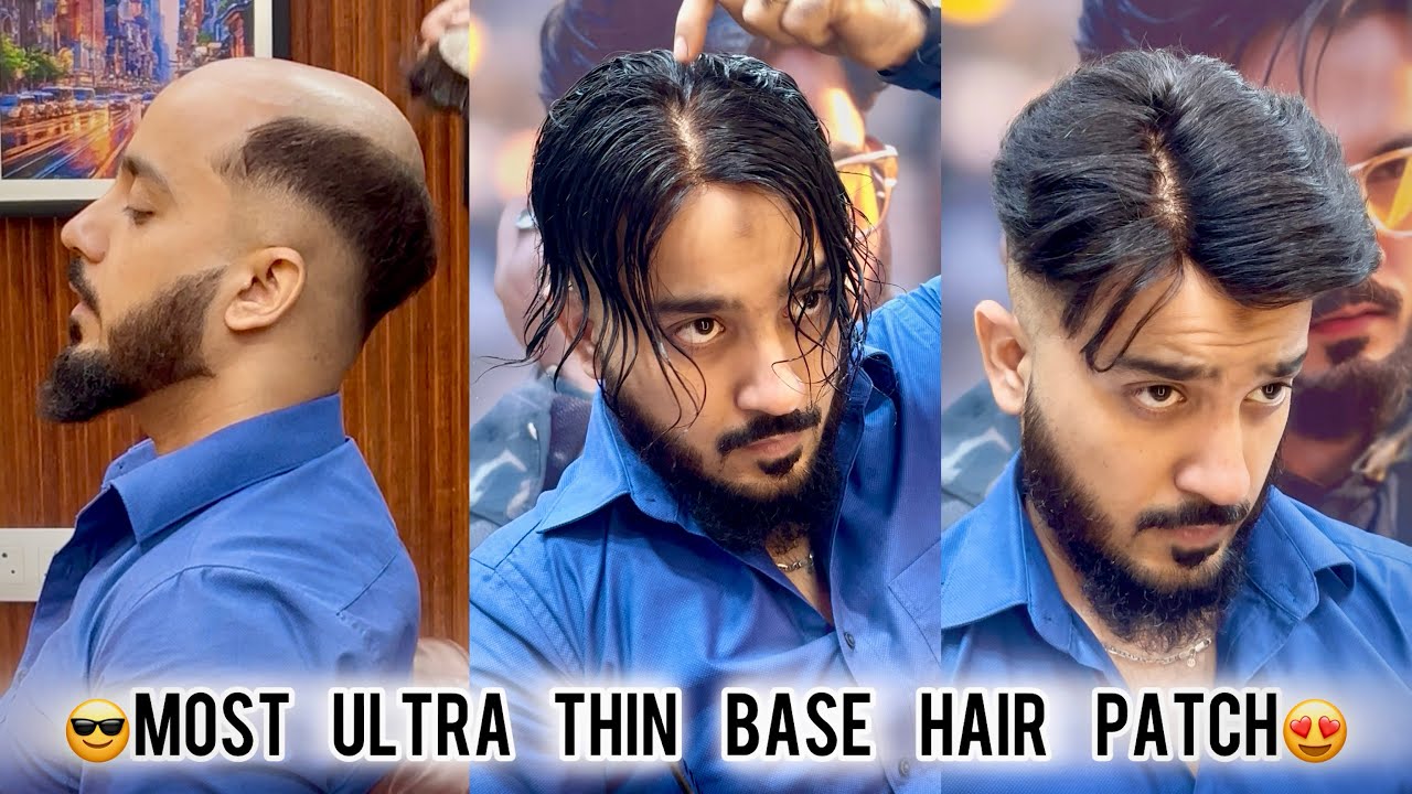 Best Ultra Thin Hair Patch | Permanent Hair Patch Delhi | Call on ...