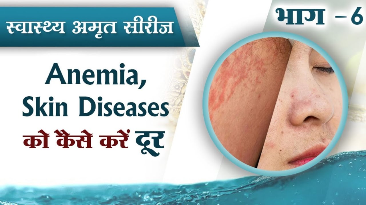 Anemia, Skin Diseases को कैसे करें दूर.... स्वास्थ्य अमृत सीरीज - 6 II ...