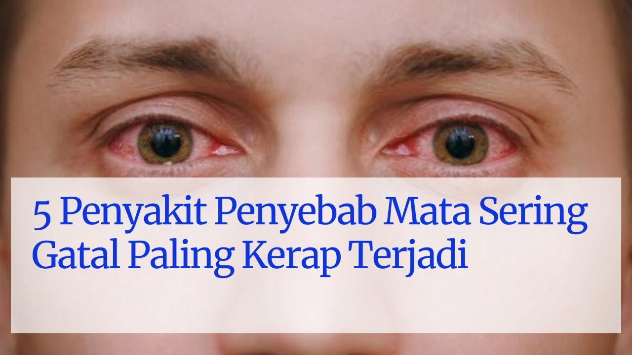 Penyakit Ini Bisa Menyebabkan Mata Sering Gatal - YouTube