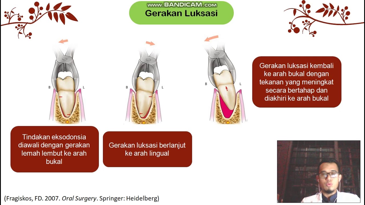 Teknik Eksodonsia_VIDEO PEMBELAJARAN FKG UNEJ - YouTube