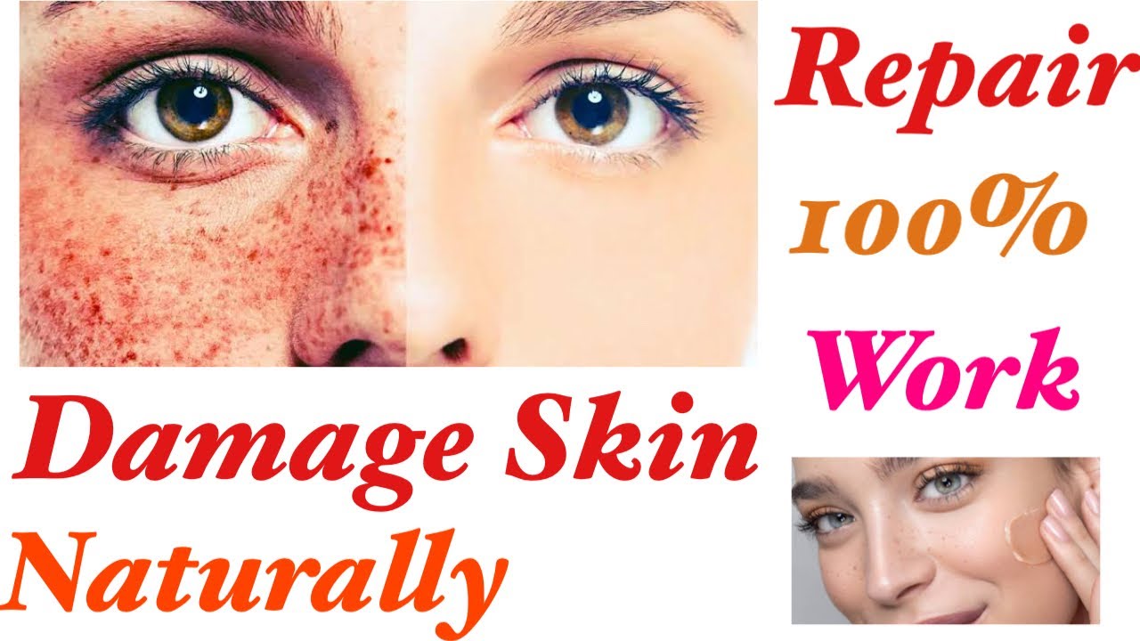 How to Repair Damage Skin With Naturally at home | Formula Cream Se ...