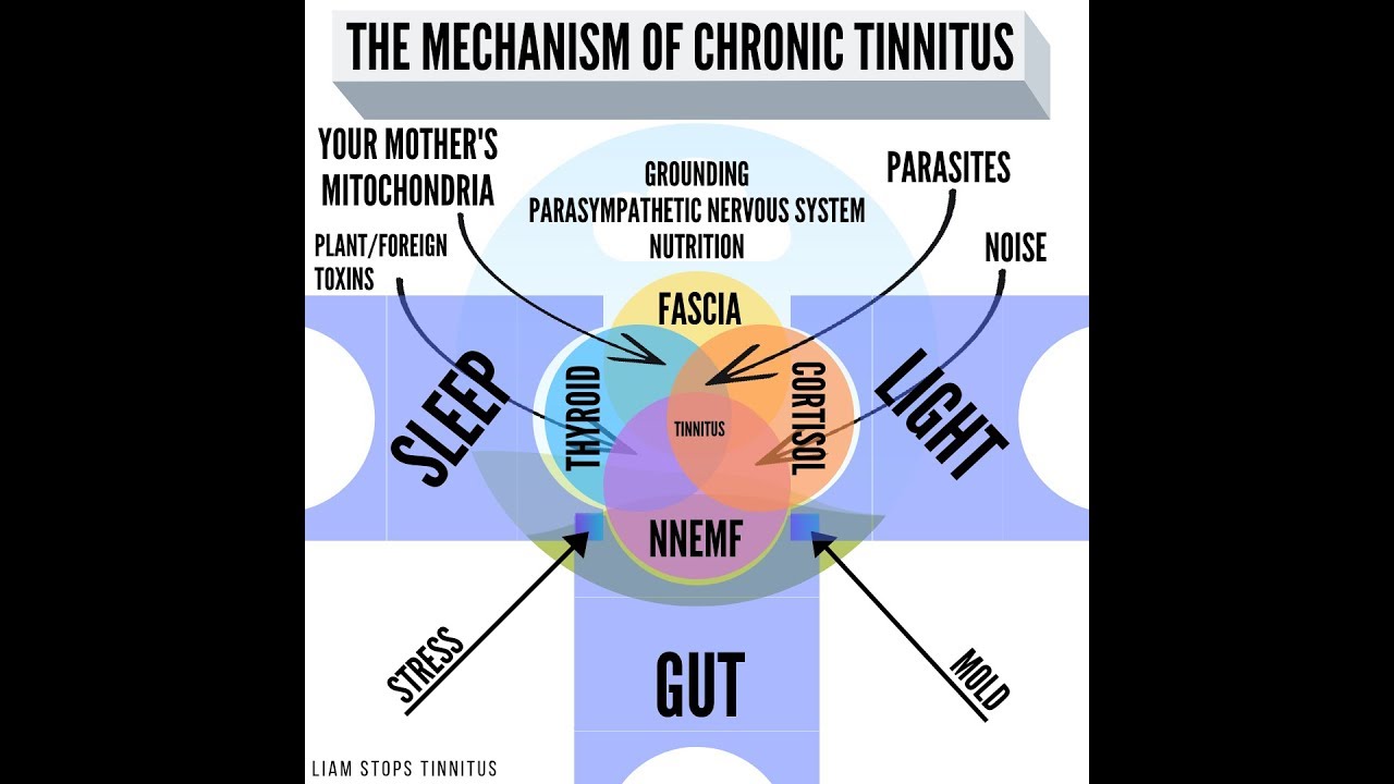 The Mechanism Of Chronic Tinnitus (Introduction) - YouTube