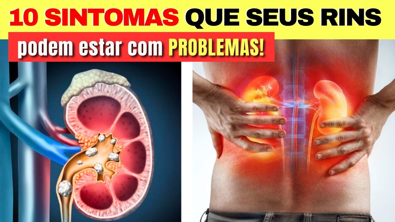 10 SINTOMAS que SEUS RINS PODEM NÃO ESTAR BEM! (sinais de insuficiência ...