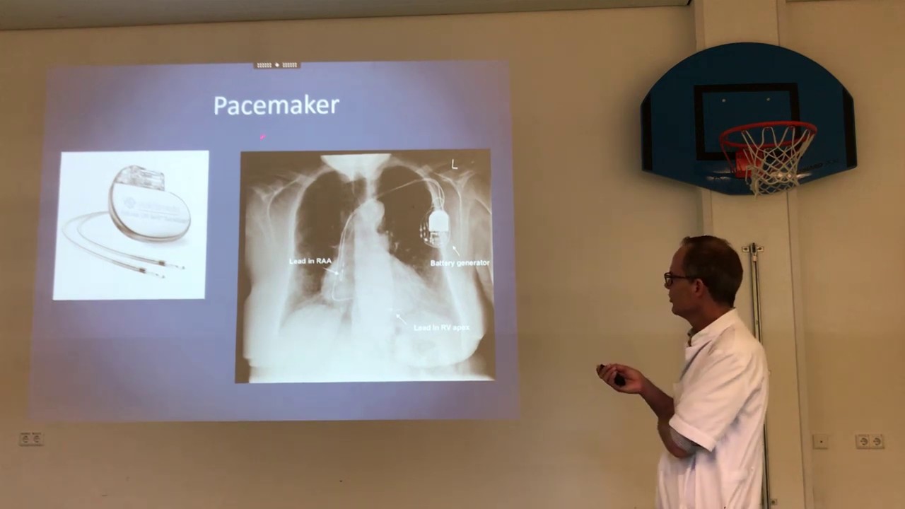 Hartritmestoornissen, pacemaker en klepafwijkingen- cardioloog Ikazia ...