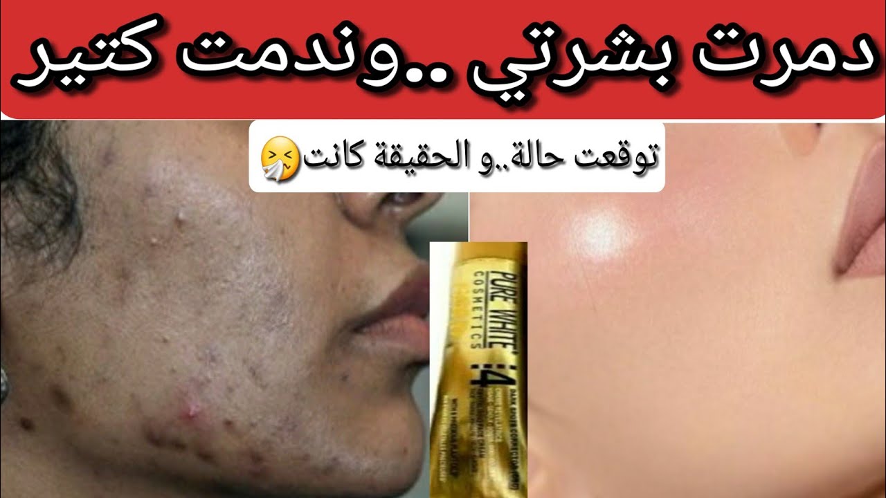 تجربتي مع كريم بيور وايت الذهبيpure White كانت هكذا🤧شيى مضحك و مبكي بنفس الوقت🤕 👇 Youtube