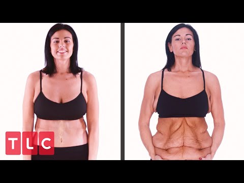 Incredible Skin Removal Transformations | Skin Tight