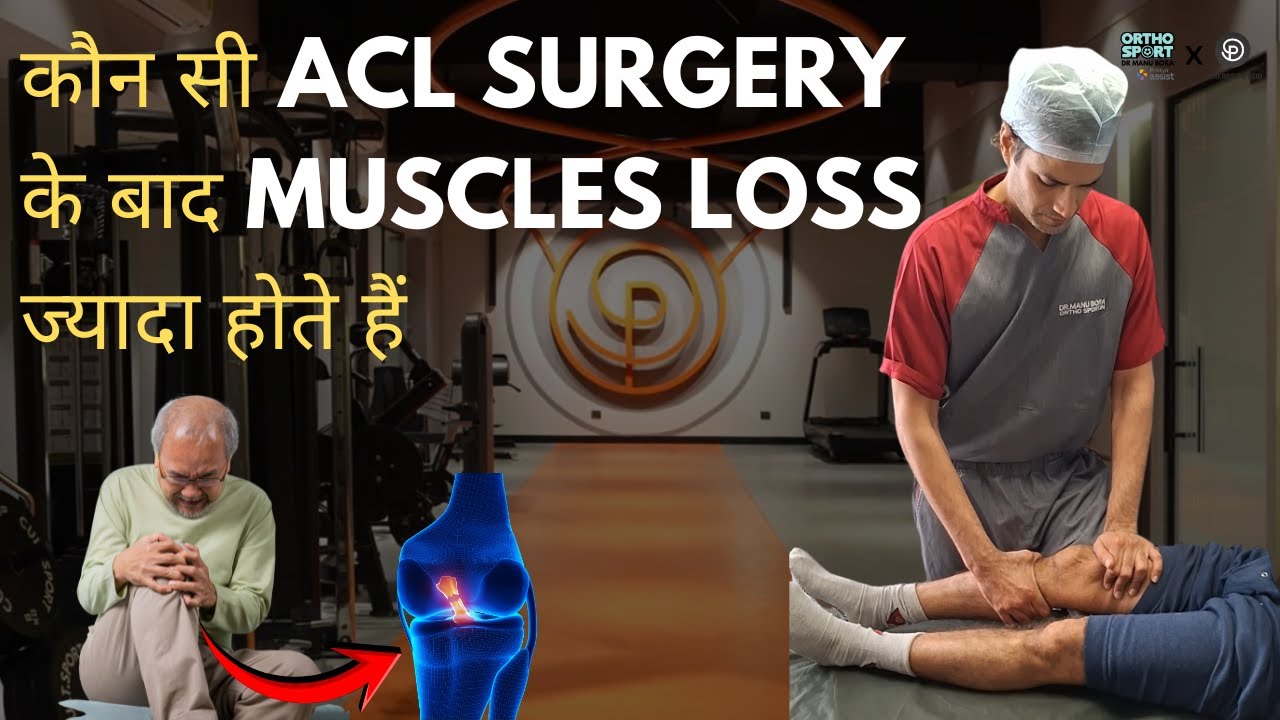 कौन सी ACL Surgery के बाद Muscles loss ज्यादा होते हैं ? - YouTube