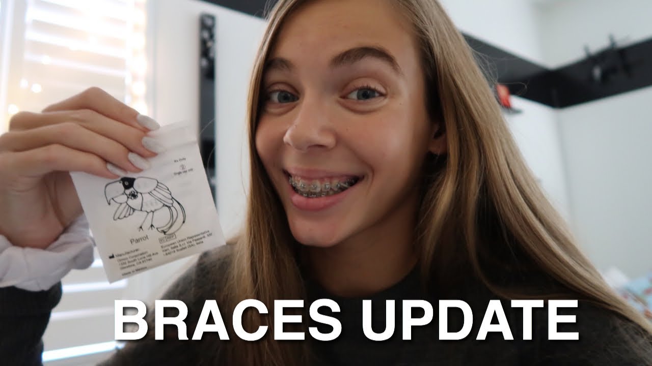BRACES UPDATE! - YouTube