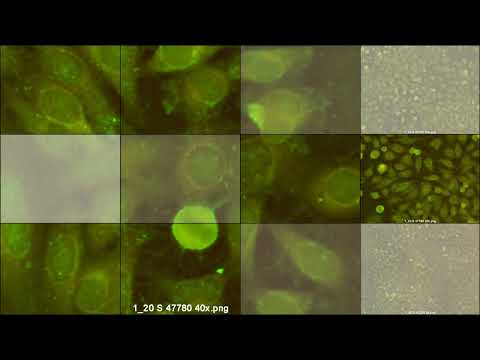 ANA HEp2 Patterns canine serums