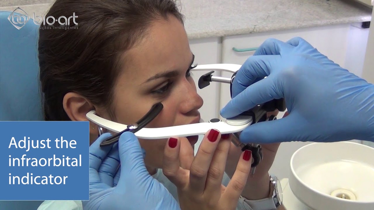 Facebow registration and assembly in semi-adjustable articulator (Step ...