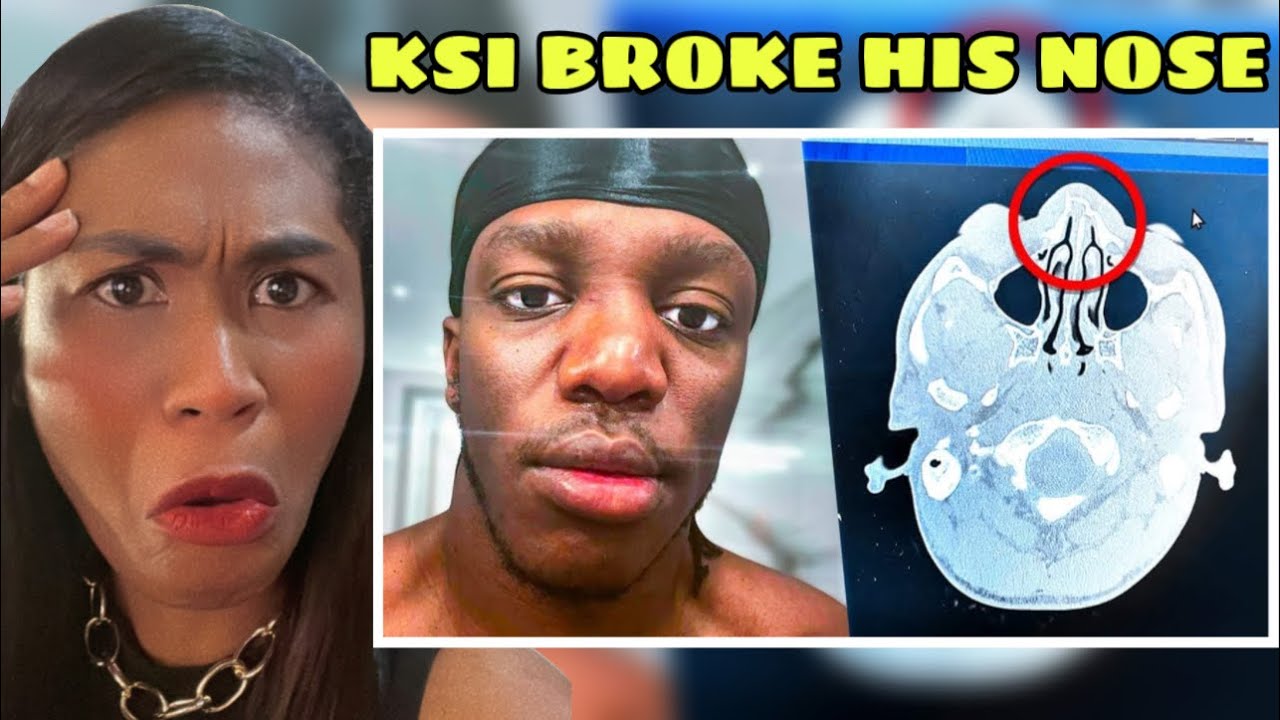 KSI - I've Broken My Nose | Reaction - YouTube