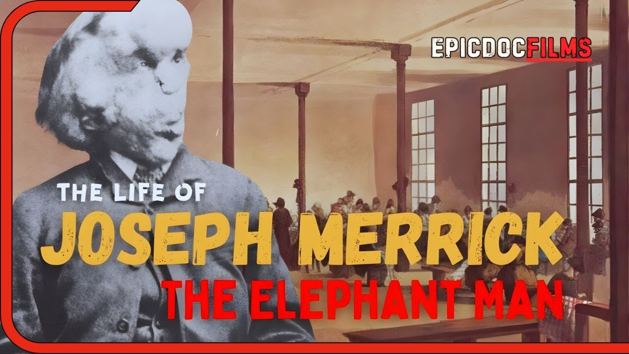 The Elephant Man | The True Story of Joseph Merrick | Victorian History ...