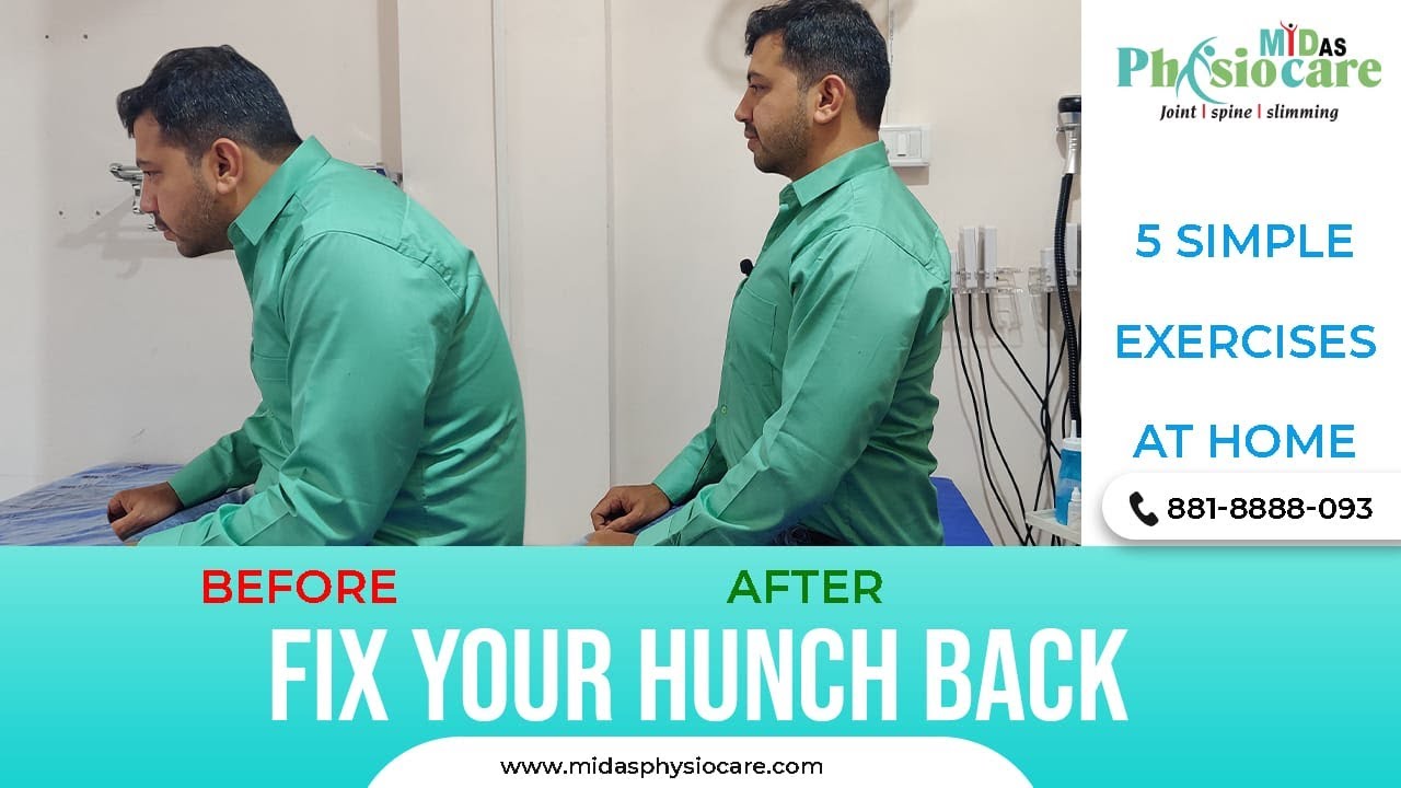 How to Fix your Hunch Back -Best exercises for Upper back pain | Dr ...