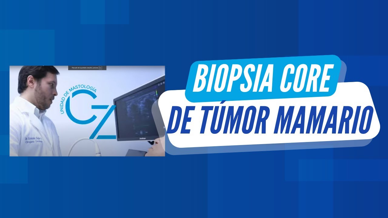Biopsia Core de Mama Guiada con Ecografia - YouTube