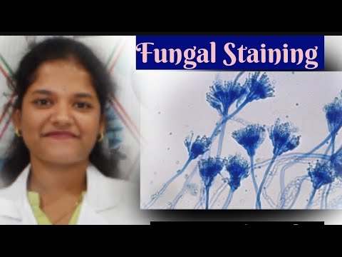 Fungal Staining Procedure। Lactophenol Cotton Blue staining | Staining ...