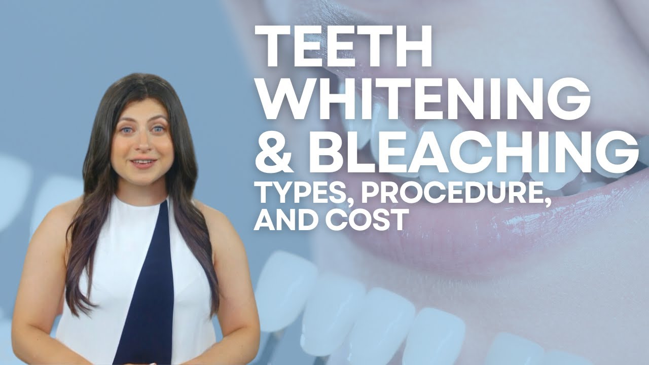 Professional Teeth Whitening & Bleaching: Types, Procedure, and Cost ...
