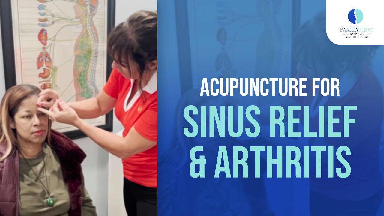 Acupuncture for Sinus Relief & Arthritis | Affordable chiropractors ...