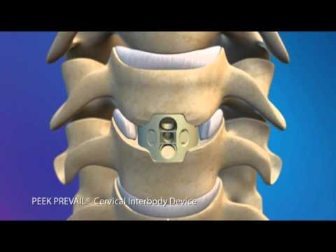 PEEK prevail animation - YouTube