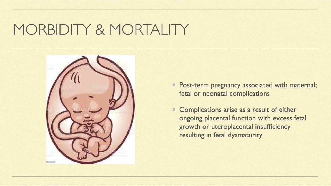 When delivery is overdue - Dr K Japhtha - YouTube